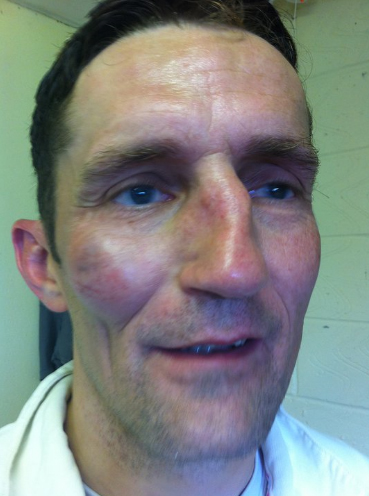 Wood & Allum put Acle to the sword. – Great Melton Cricket Club